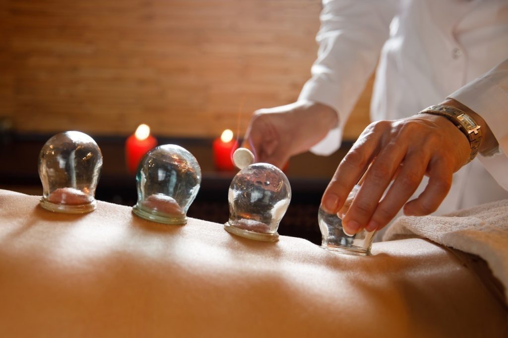 La Hijama, Une Pratique Thérapeutique Ancestrale Recommandée Par Le ...
